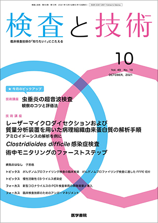 検査と技術 Vol.49 No.10 (発売日2021年10月01日) | 雑誌/定期購読の予約はFujisan